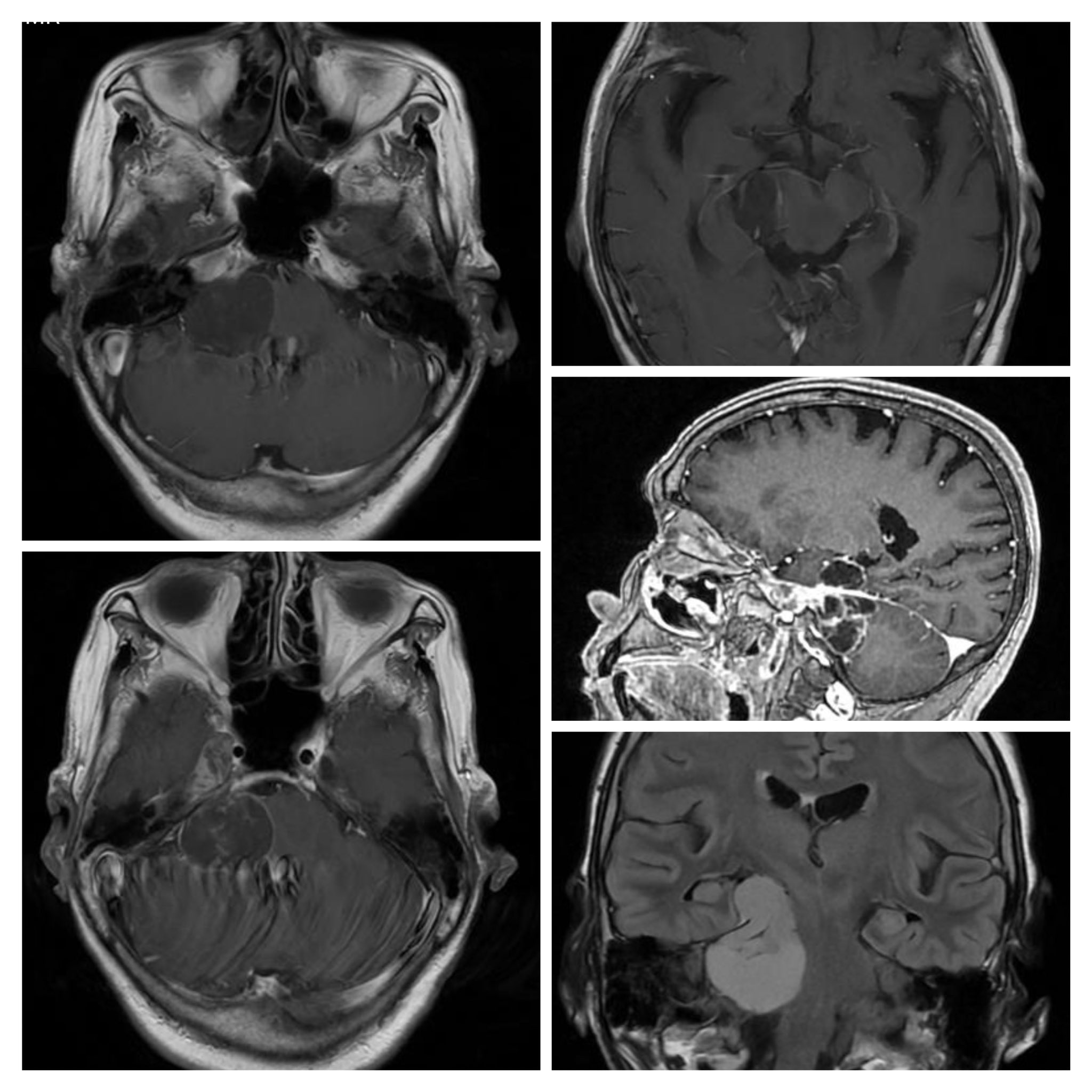 PANS – Pakistan Academy of Neurological Surgery